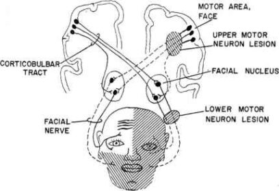 Cranial Nerve Face Drawing Pic - Drawing Skill