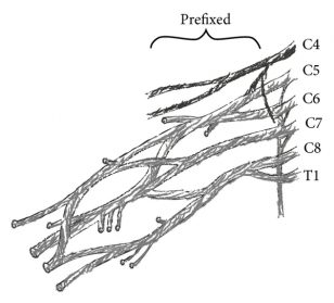 Brachial Plexus Drawing Creative Art - Drawing Skill