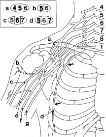 Brachial Plexus Drawing Realistic - Drawing Skill
